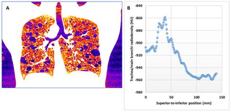 Bioengineering Special Issue Recent Advances In Biomedical Imaging