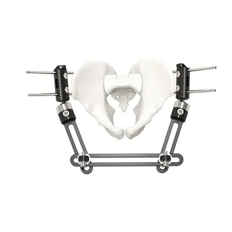 Fracture Surgery External Fixation Instrument Knee Joint Tibia