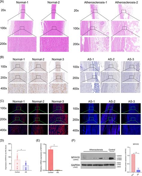 Verification For The Role Of Myosin Heavy Chain 10 Myh10 Based On