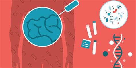 Microscopic Colitis Healthpath