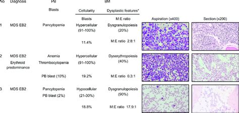 Summary Of Bone Marrow Examinations Of The Three Patients With