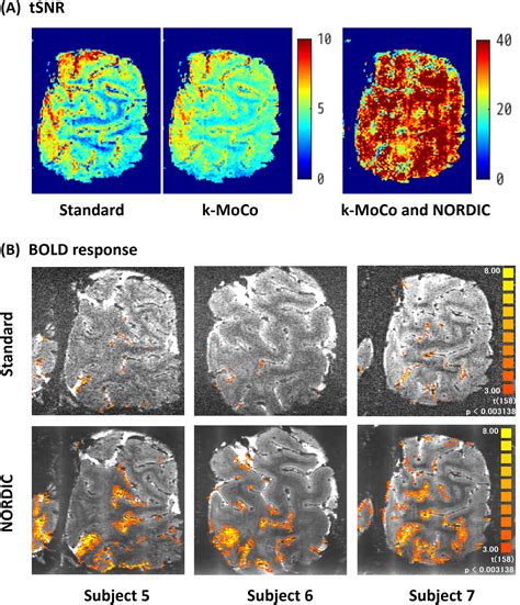 Block‐interleaved Segmented Echo‐planar Imaging For Improved Activity