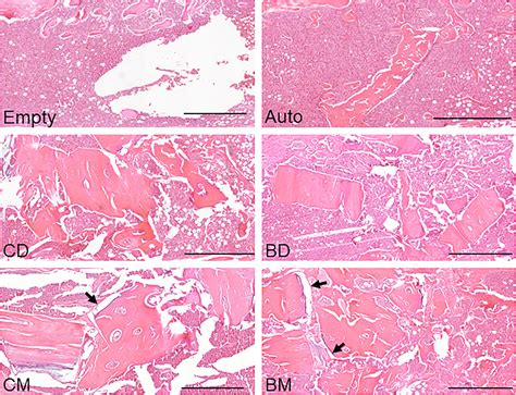 Donor Bisphosphonate Treatment Negatively Impacts Mineralized
