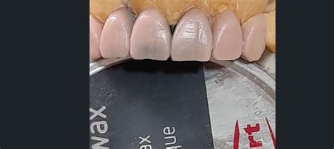 Arbia Attafi Posted On Linkedin