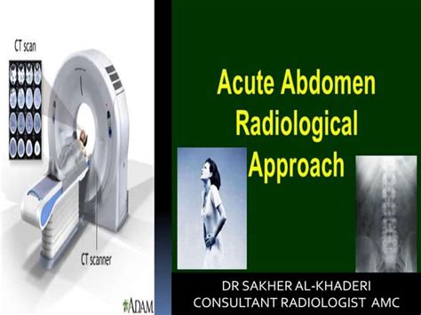Imaging Of Acute Abdomen Pptx