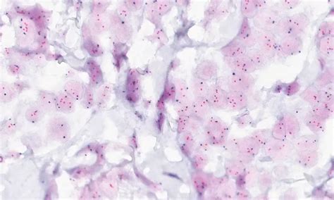 Philips Pathology Scanner Sg60 Fdp0909