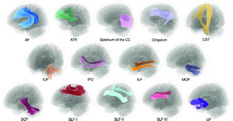White Matter Tracts Of Interest White Matter Pathways Reconstructed