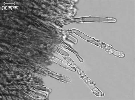 Cystidia Of Veluticeps Berkeleyi Download Scientific Diagram
