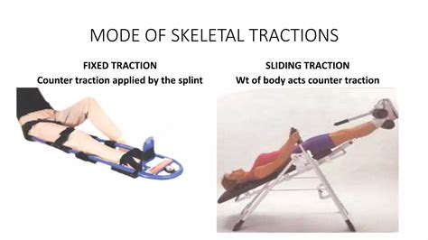 Splints And Tractions Pptx