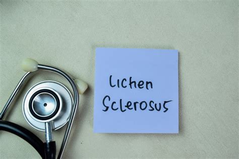 What Is Lichen Sclerosis My Obgyn Specialists