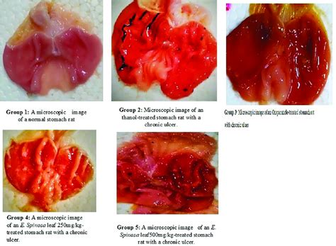 Microscopic Evaluation Of Chronic Aspirin Induced Gastric Ulcer Group Download Scientific