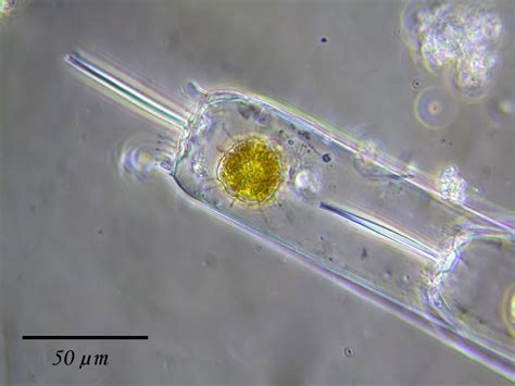 Ditylum Brigh Diatomées Collections Mikroscopia
