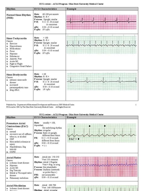 Ekg Examples Electrocardiography Cardiovascular System Ekg Hot Sex