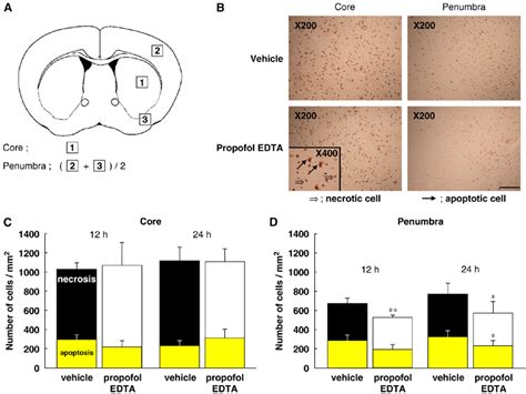 Effect Of Propofol Edta On Tunel Staining After Mcao Propofol Edta 10