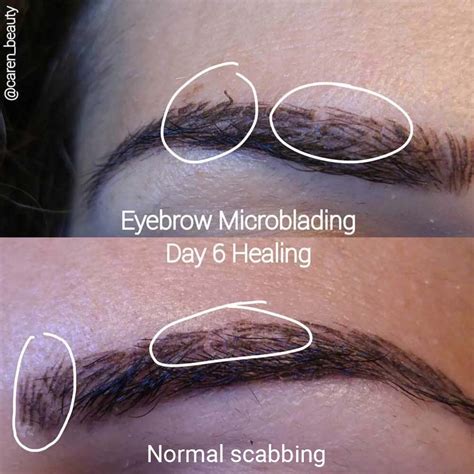 Does Microblading Affect Hair Growth The Only Truth
