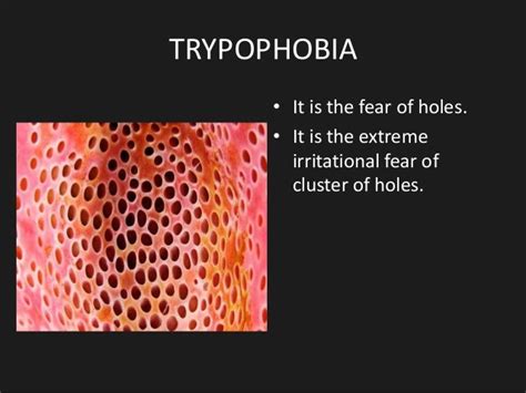 Common Types Of Phobia