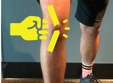 Mcl Tear Recovery Time And Rehabilitation Jaco Rehab