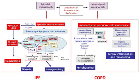 Pathogenic Scheme Of Ipf And Copd The Complex Effects Of Either