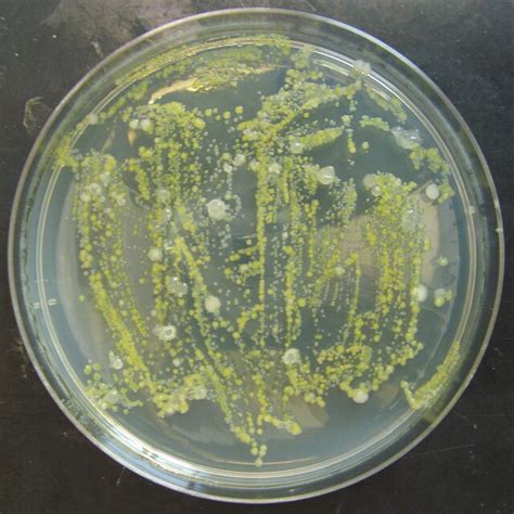 Representative Lb Plate Showing The Various Types Of Microorganisms