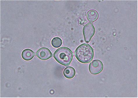 Paracoccidioides Brasiliensis Mold Microscopic Morphologic Features Of