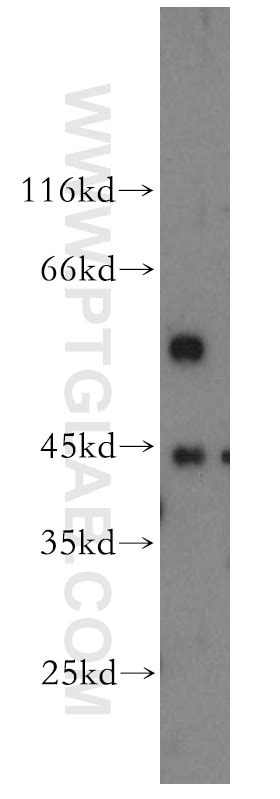 Dnmt2 Antibody 19221 1 Ap Proteintech