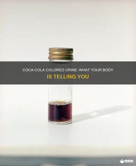 Coca Cola Colored Urine What Your Body Is Telling You Medshun