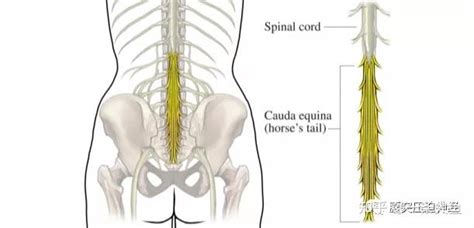 马尾神经损伤导致二便功能障碍 知乎