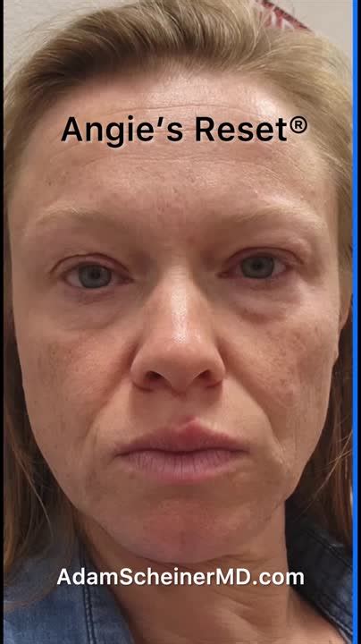 Adam Scheiner M D On Linkedin Still Not Sure I Recognize Myself And Definitely Didnt