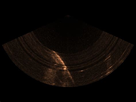 Sonar Object Detection Dataset By Yolov8