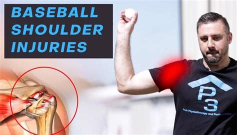 Baseball Shoulder Injuries 3 Leading Causes Of Shoulder Pain