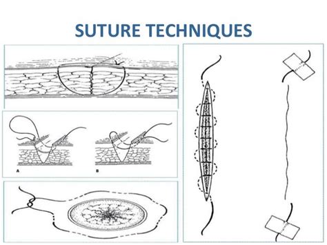 Basic Surgical Skills