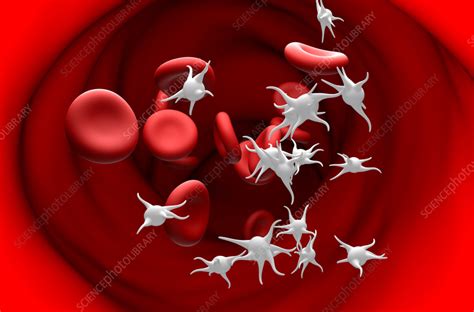 Essential Thrombocythaemia Illustration Stock Image F0400849