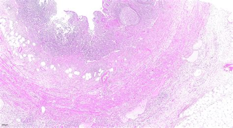 Eosin Staining Solution Pr30019 Proteintech