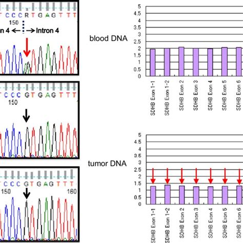 Results Of Genetic Analysis A Direct Sequencing Of The Sdhb Gene In Download Scientific