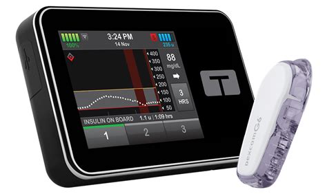 Tandem T Slim Pump And Supplies Order Southeast Diabetes Inc