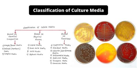 Culture Media Archives Biology Notes Online