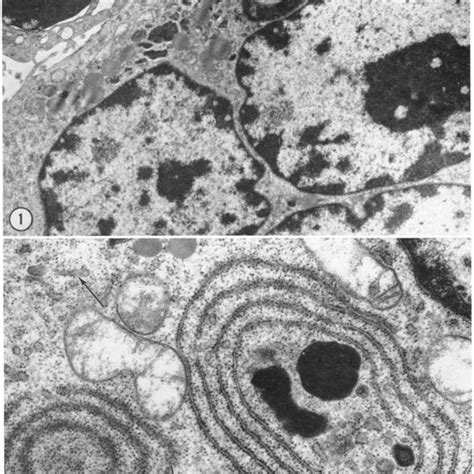 Portion Of A Multimicronucleated Cell Showing Sections Of Four Nuclei