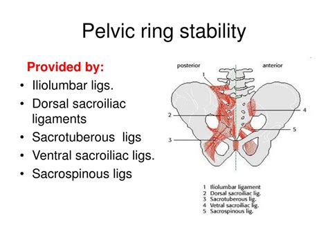 Ppt Comprehensive Guide To Pelvic Fractures And Stability Framework