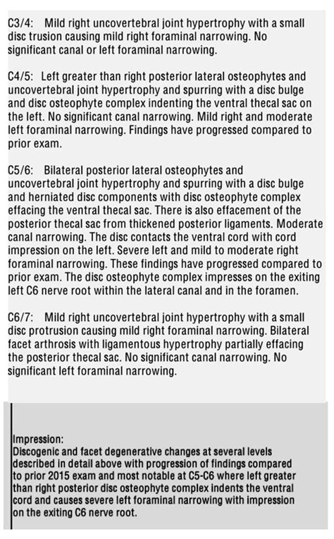 30 Yo Female 2 Level Artificial Cervical Disc Replacement Rspinesurgery