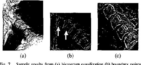 Figure 1 From Vertebra Shape Classification Using Mlp For Content Based