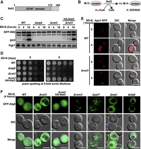 Function And Molecular Mechanism Of N Terminal Acetylation In Autophagy Cell Reports