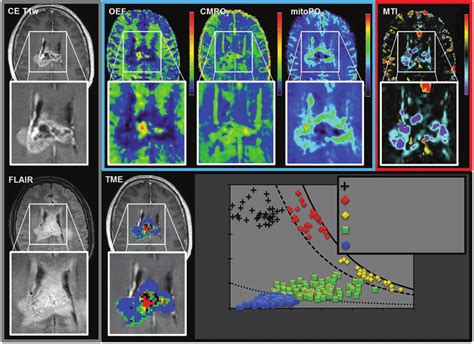 Conventional Anatomic Mri Cmri Grey Box Oxygen Metabolism Oef Download Scientific Diagram