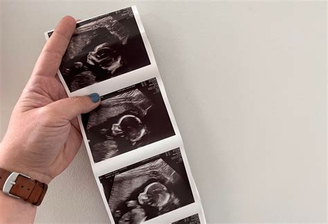 Anatomy Scan What Pregnant Moms Should Expect The Well By Northwell