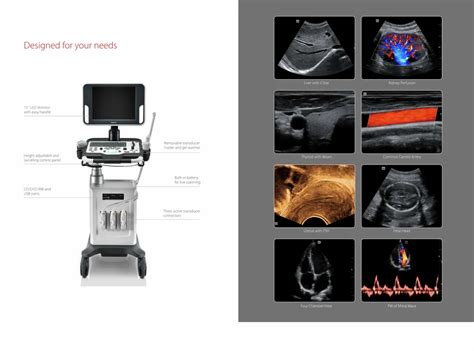 Mindray Dc 30 Ultrasound System At ₹ 900000 Mindray Sonography Machine In Patna Id