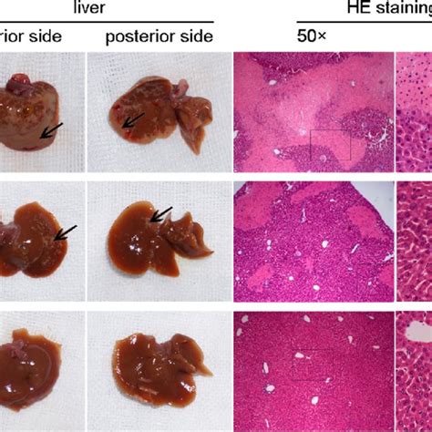 Appearance And He Staining Of The Liver 24 H After 10×10 6 50×10 5