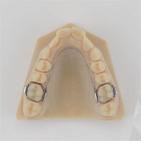 Controlled Arch Johns Dental Lab