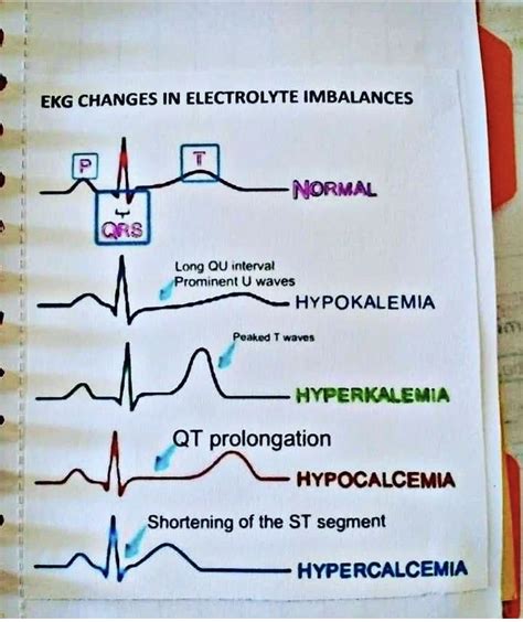 10 Steps To Learn Ecg Interpretation Artofit