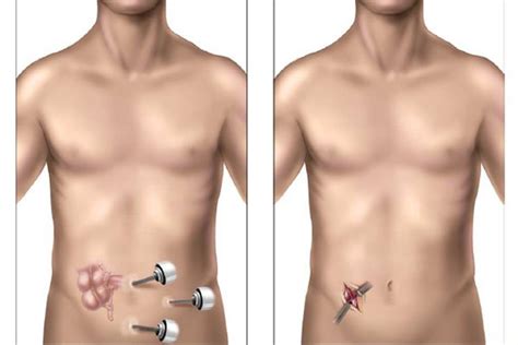 Appendix Pain Seek Help Now Shri Tirupati Hospital