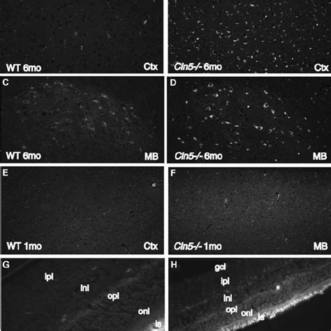 Interneuron Staining In The Brains Of 6 Month Old Mice Immunostaining Download Scientific
