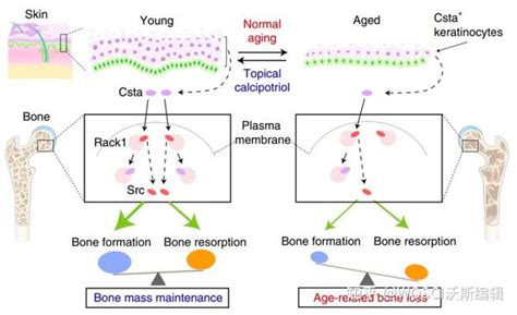 Nature Aging 皮肤衰老导致骨质疏松！南方医科大学揭示皮肤对骨代谢的关键调节机制 知乎